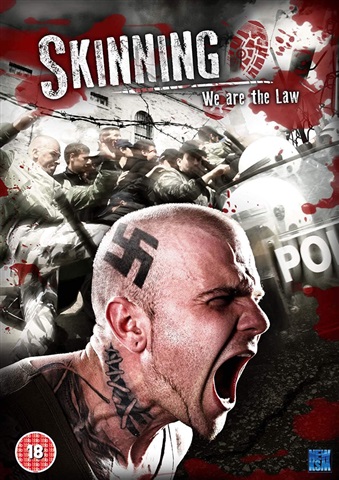 Skinning, We Are The Law (18) 2010 - CeX (UK): - Buy, Sell, Donate